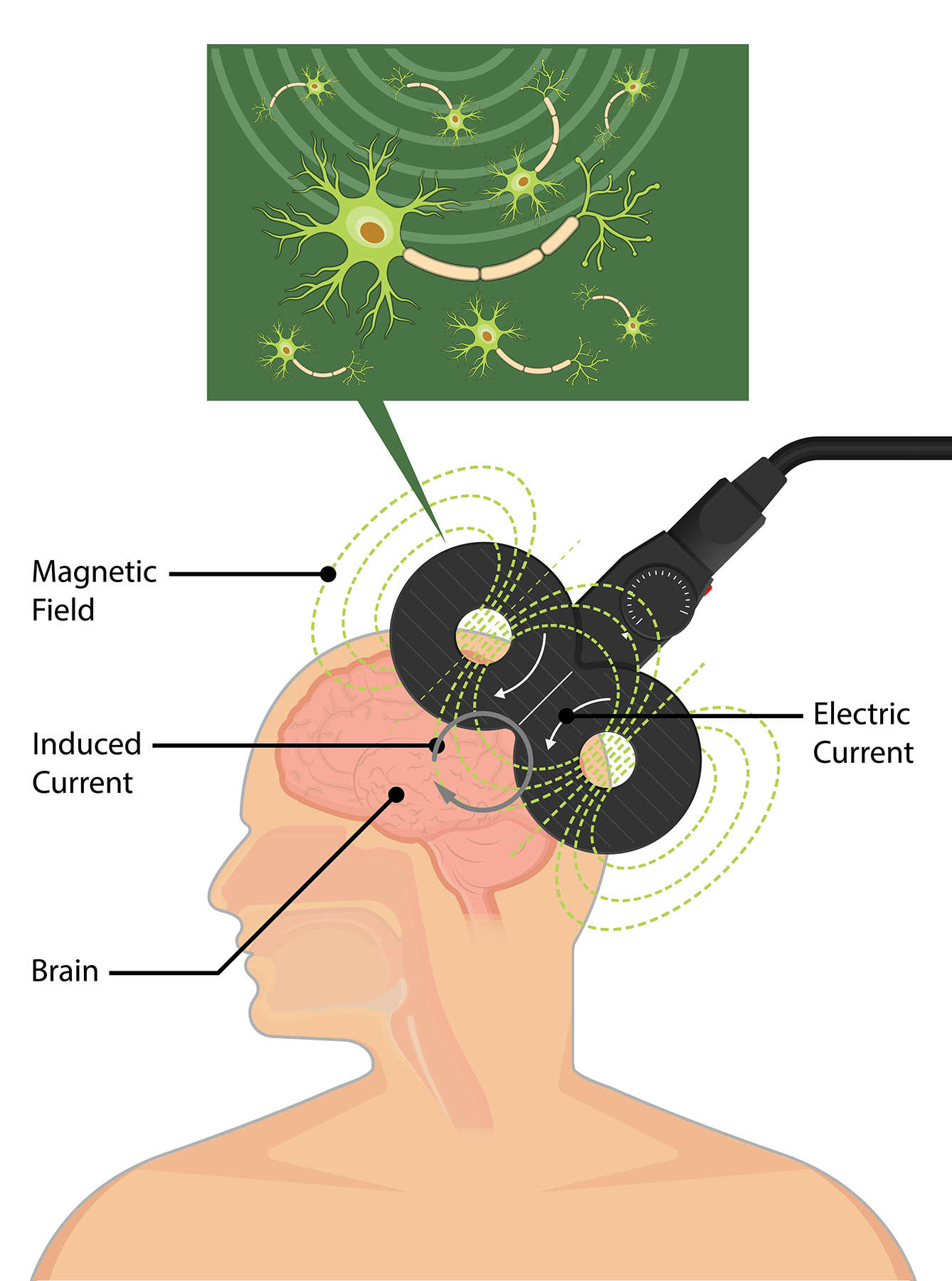 TMS – Trinity Wellness Center
